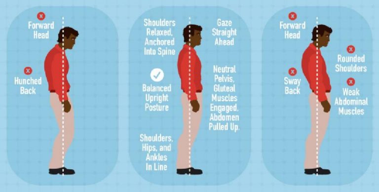 The Ultimate Guide To Posture Correction - Spine & Posture Care Sydney