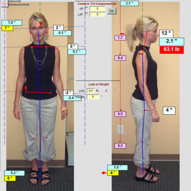 $97 New Patient Posture Offer | Spine and Posture Care